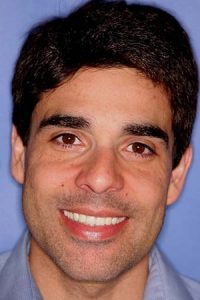Smile Gallery - Dr. Neal C. Johnson - Before & After Photos